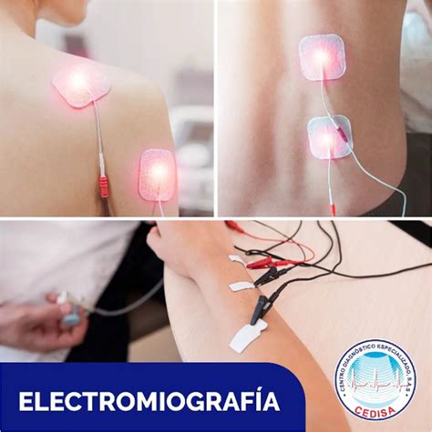 Cedisa Nuevo Servicio Disponible Electromiografía