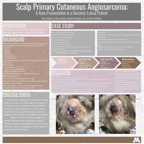 Pdf Primary Cutaneous Angiosarcoma A Rare Presentation In A Geriatric Latina Patient Scalp