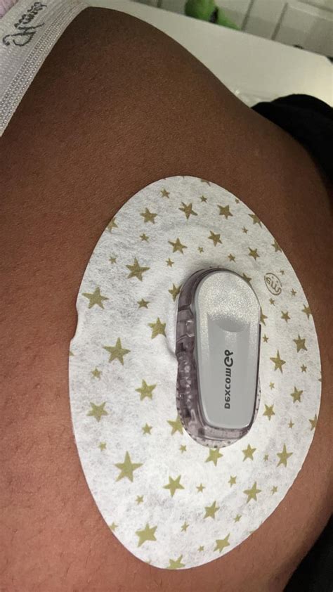New Tape Is This Cute Or What R Dexcom