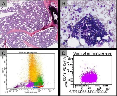 Bone Marrow Biopsy Showed Hypercellular Bone Marrow With Sheets Of