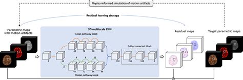 The Menze Group Develops A Convolutional Neural Network For Residual Motion Correction In Fast