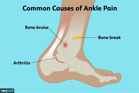 Foot Ankle Surgery And Some Causes Dr Babajide A Ogunlana Dpm Facfas Wes