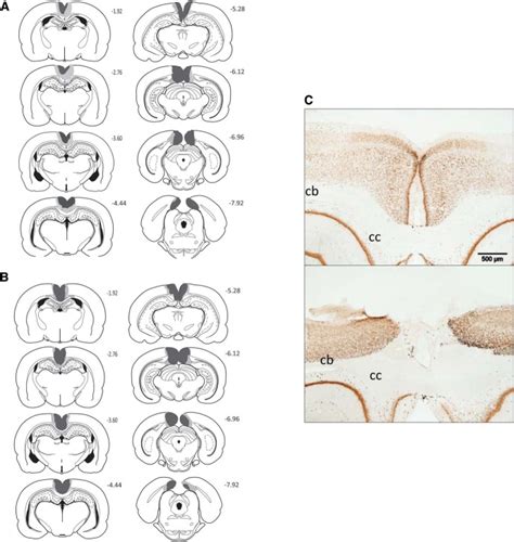 When Is The Rat Retrosplenial Cortex Required For Stimulus Integration Pmc