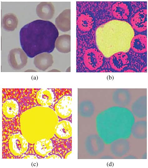 csse free full text automated leukemia screening and sub types