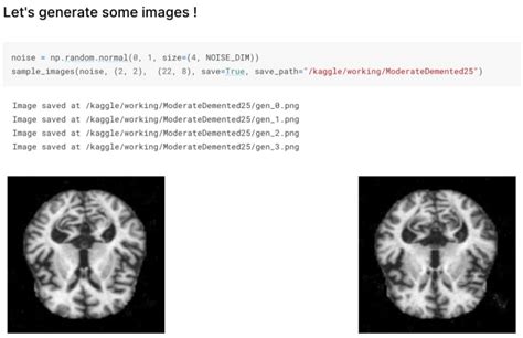 do image data augmentation using generative adversarial networks gans by hina tufail fiverr