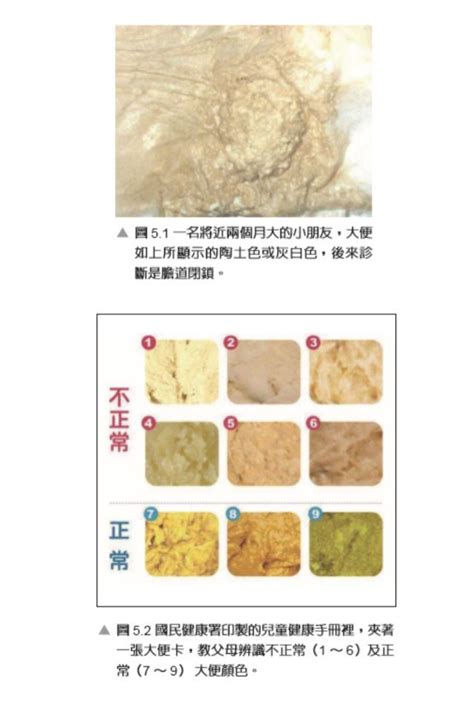 寶寶便便顏色看健康，這6色代表不正常！嬰兒便便顏色對照表幫助判斷