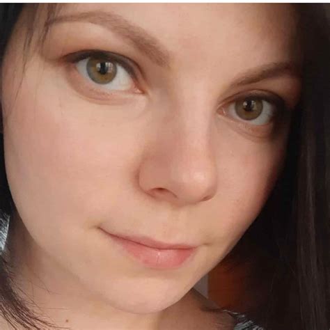 Бесшовная блефаропластика нижних век Цены в Москве