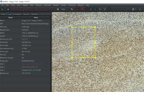 I Couldnt Use Cell Detection In Qupath 060 Usage And Issues Image