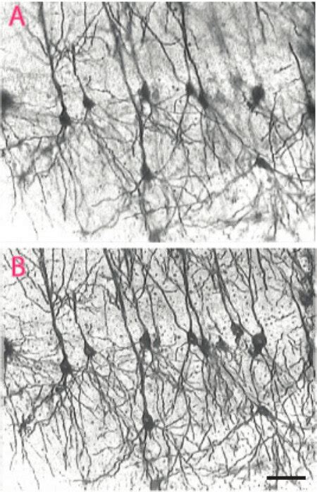 Visualization Of Dendritic Arborization Without A And With Edfi B Download Scientific