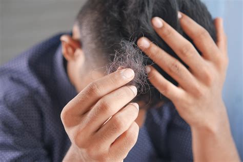 【脫髮】脫髮引發負面情緒 3大健康方法有效改善脫髮問題丨劉英健博士