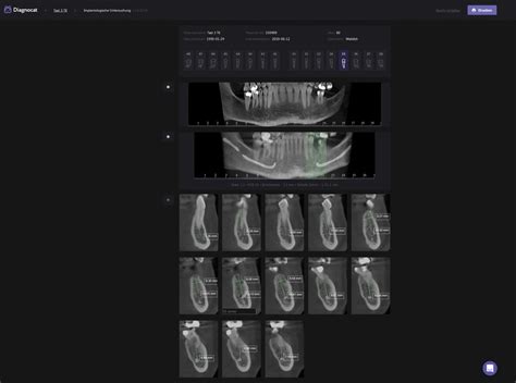 Artificial Intelligence And Deep Learning In Dental Radiology