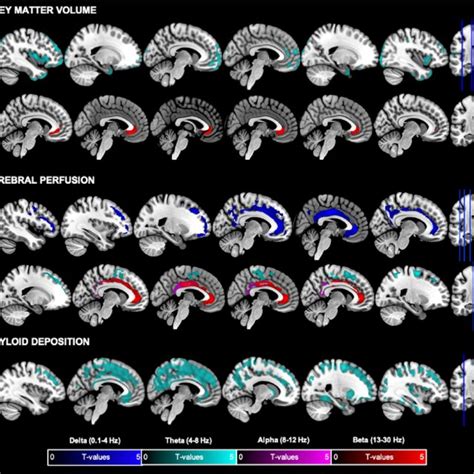 Multimodal Neuroimaging Correlates Of Rapid Eye Movement Sleep Download Scientific Diagram