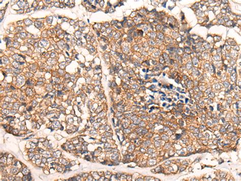 兔抗cacna2d2多克隆抗体anti Cacna2d2 Rabbit Polyclonal Antibody 生命科学产品与技术服务 生工