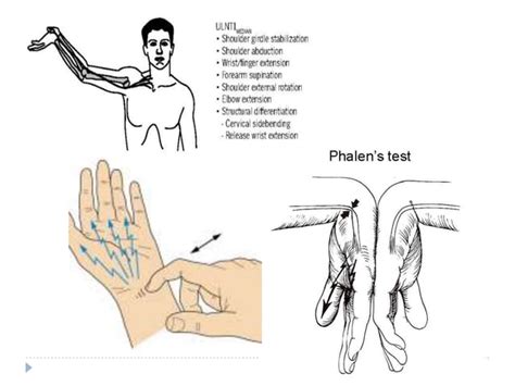 Anatomy Of Median And Ulnar Nerve And Applied Anatomy Ppt