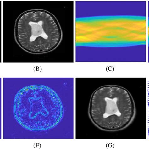Example Of A Nonparametric Multimodal Image Registration By Using Our