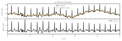 Electrocardiogram — Detkit Manual