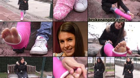 Brandy Slwc Gimping In The Cold With And Without Cast Sock On Her Pretty Pink Pedicured Toes