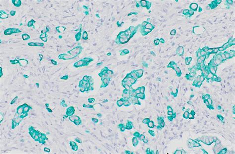 delaunay cluster features in qupath quantification image analysis