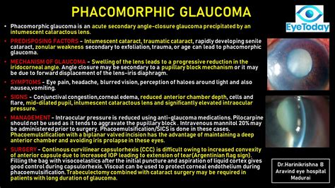 Phacomorphic Glaucoma Eyetoday