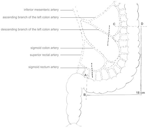 Application Of Mesocolon Rotation And Reverse Puncture In Total