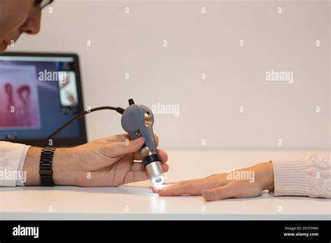 Systemic Sclerosis Diagnosis Concept Hands Of A Doctor And A Patient Are Visible With Diagnosis