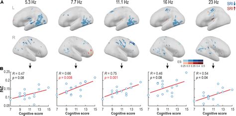 Frontiers Cortical Cross Frequency Coupling Is Affected By In Utero Exposure To Antidepressant