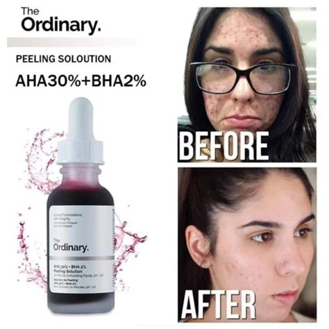 سرم لایه بردار پیلینگ اوردینری بهاراشاپ