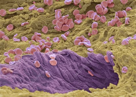 Tumour Blood Vessel Sem Stock Image C0573265 Science Photo Library