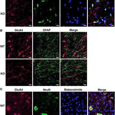 The Glua4 Ampar Subunit Is Reduced In Adult Spinal Cord Download