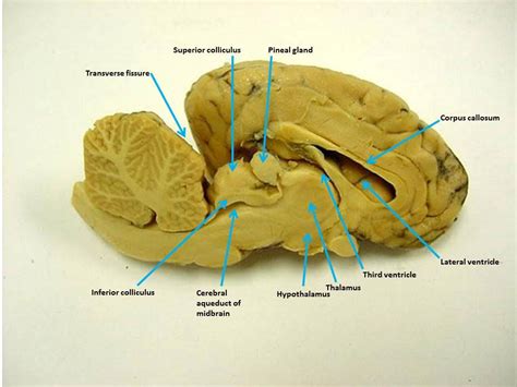 Label The Parts Of The Dissected Sheep Brain Medial Section At Humberto Watts Blog