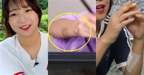 온 몸에 멍 달고 살았던 쯔양…거의 매일 맞으면서 방송