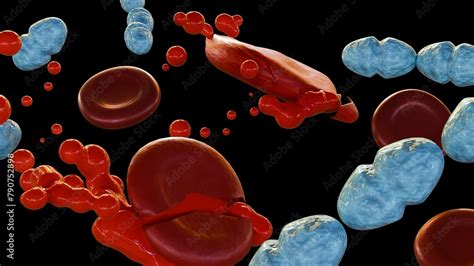 3d Rendering Of Septicemia Or Sepsis Is The Clinical Name For Blood