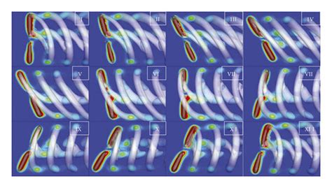 A Instantaneous Vortices Visualized With The Isosurface Of Q 0 01 Download Scientific