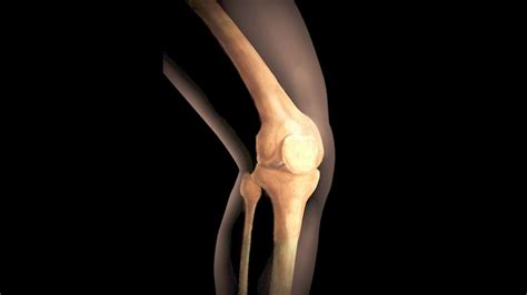 45 Facts About Small Patella Syndrome