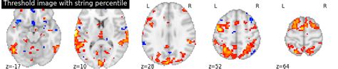 Nilearn Statistical Analysis For Neuroimaging In Python — Machine Learning For Neuroimaging