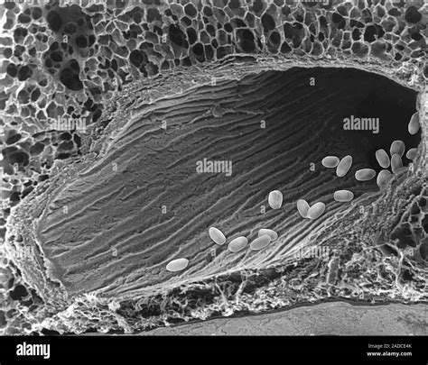 Scanning Electron Micrograph Sem Of Photocomposite Of Bacillus Anthracis Spores In Lung