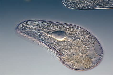 What Are Protozoa Healthtian