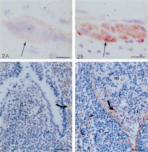 Immunohistochemical Detection Of Prp In The Ileal Peyers Patch Of Download Scientific Diagram