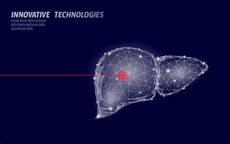 인간의 간 레이저 수술 작업 낮은 폴 리 의학 질병 약물 치료 고통 스러운 지역입니다 빨간 삼각형 다각형 3d 렌더링 모양입니다 약국 간염 암 서식 파일 벡터 일러스트 레이