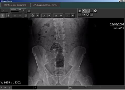 Dildo Plug Bottle X Ray Like Ra S Naughty Blog