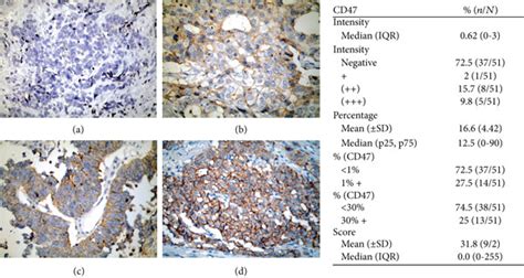 Clinicopathological And Prognostic Significance Of Cd47 Expression In Lung Neuroendocrine Tumors