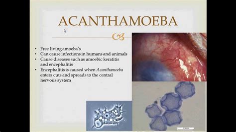 Parasitology Acanthamoeba Youtube