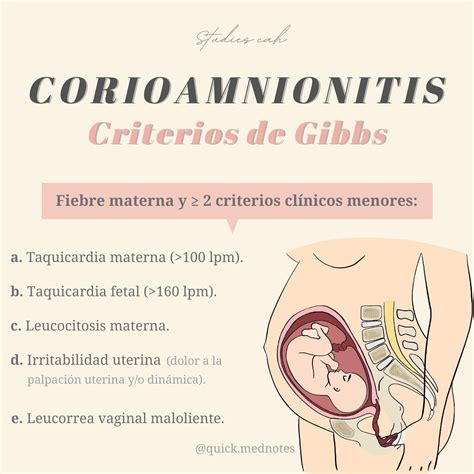 𝐐𝐮𝐢𝐜𝐤 𝐌𝐞𝐝𝐍𝐨𝐭𝐞𝐬 📓 🏼 On Instagram Criterios De Gibbs Para