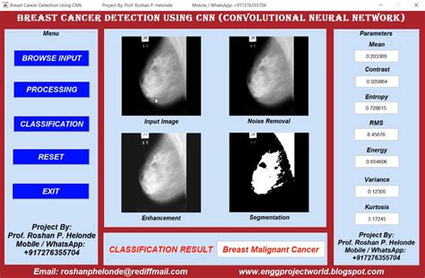 Breast Cancer Detection Using Cnn Convolutional Neural Network Matlab