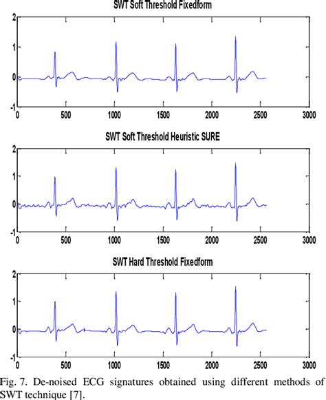 Figure 1 From Noise Reduction Of Electrocardiographic Signals Using Wavelet Transforms