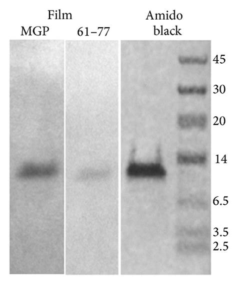 Mgp Binds To Fibronectin And To The First Type Iii Repeat Domain Of Download Scientific Diagram