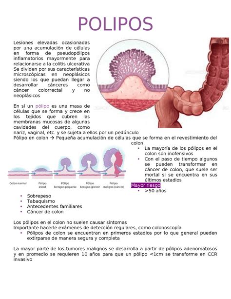 Pólipos Intestinales Resúmenes De Gastroenterología Docsity