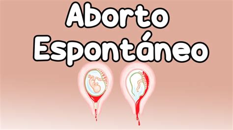 Aborto EspontÁneo Causas Síntomas Diagnóstico Y Tratamiento Youtube