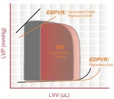 Pathology Of Pressure Volume Loop Flashcards Quizlet