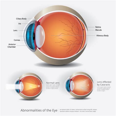 Cornea And Anterior Segment Eyeland Hospitals